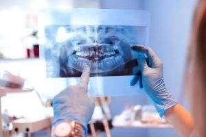Digital versus Conventional Radiography in the Dental Office